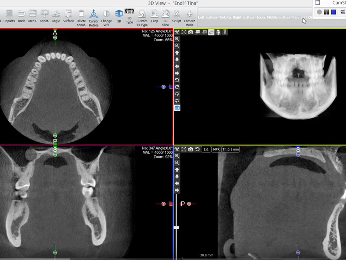 Intra-oral imaging - presidental